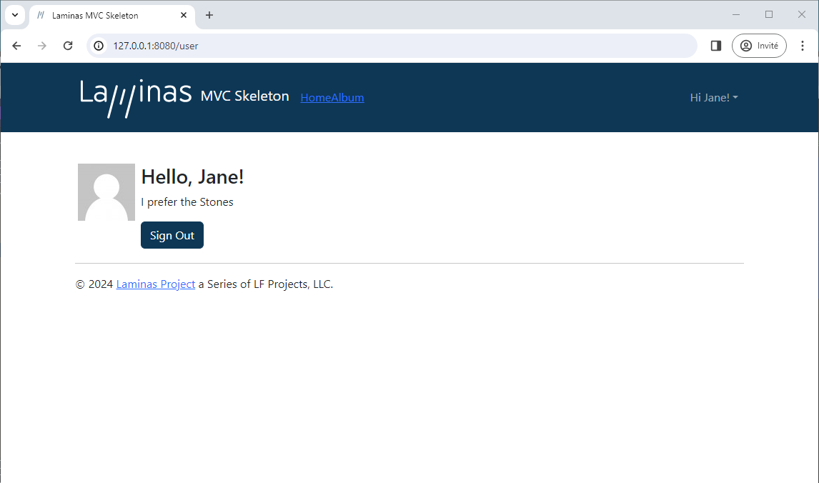 Laminas: Part 2 – Customizing LmcUser - VISTO Media